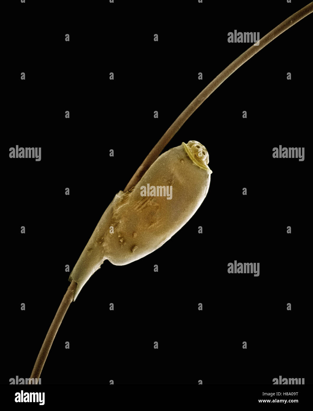 Human Louse (Pediculus humanus) SEM close-up view of egg on human hair ...