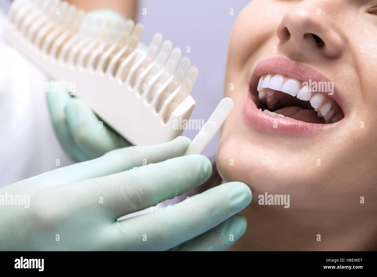 Teeth color comparison Stock Photo - Alamy