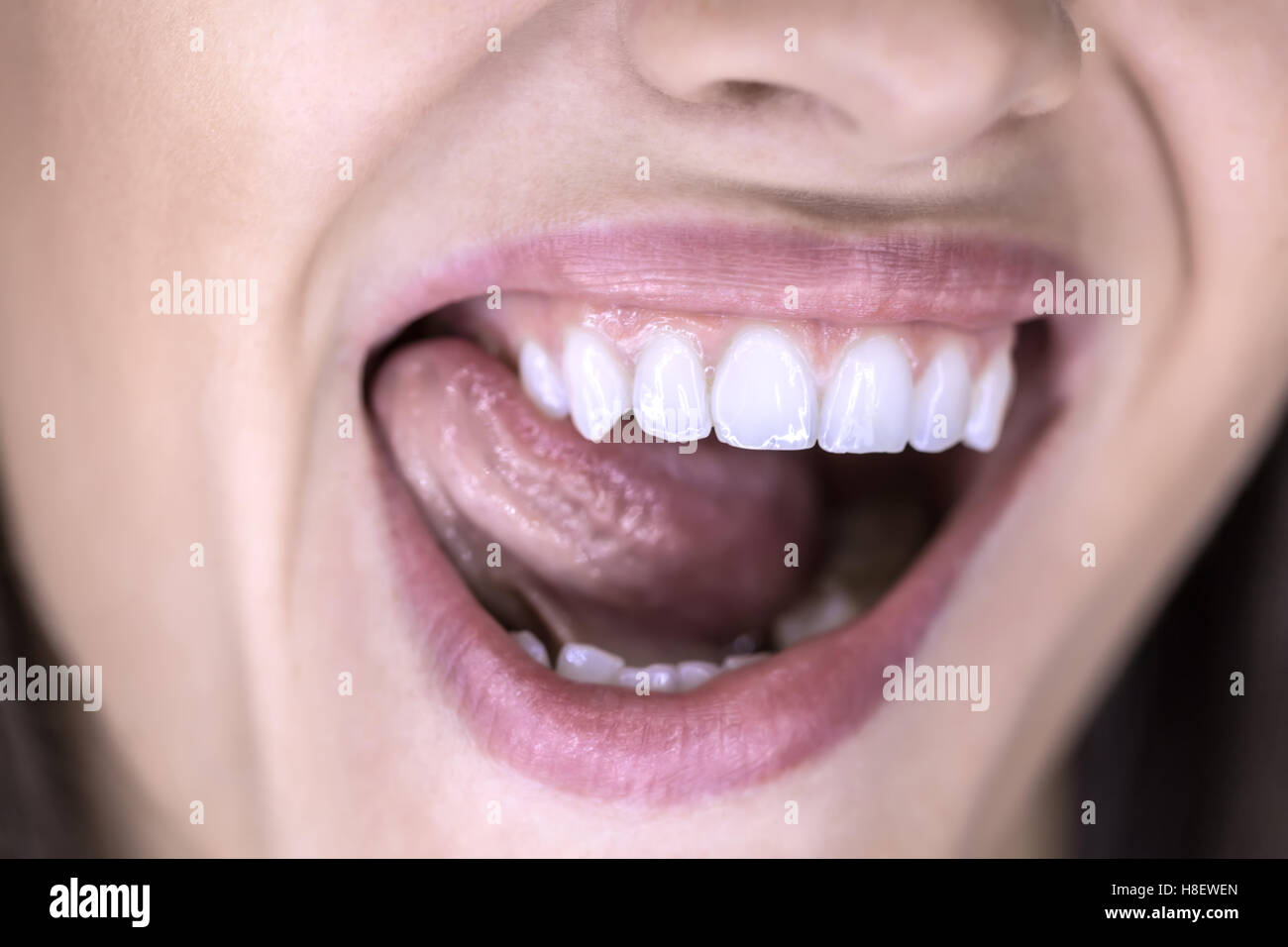 Girls teeth hi-res stock photography and images - Alamy