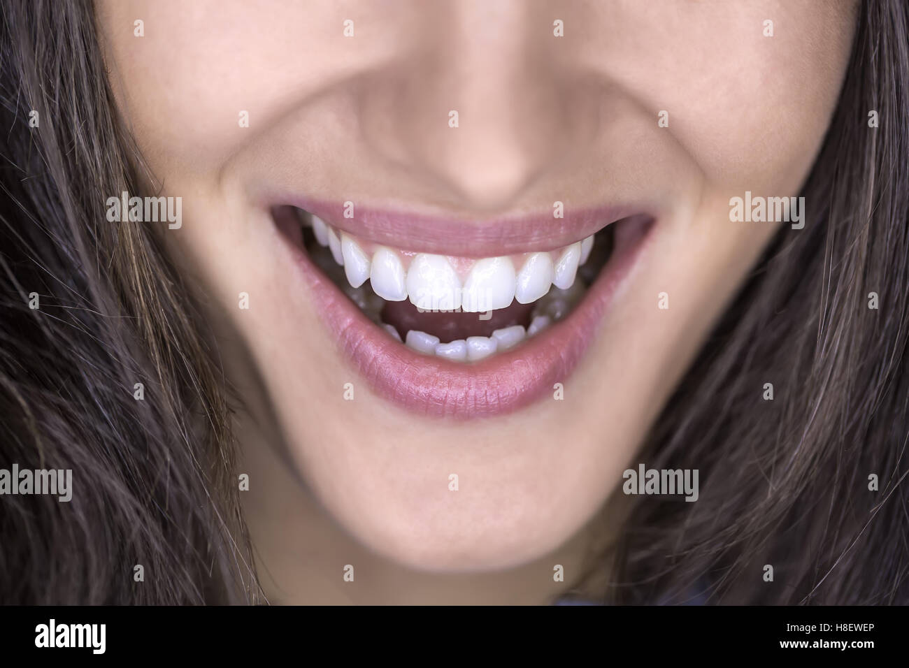 Girls teeth hi-res stock photography and images - Alamy