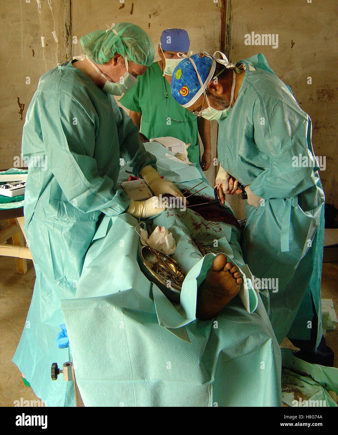 31st August 2005 An ICRC Field Surgical Team perform surgery on an SLA ...