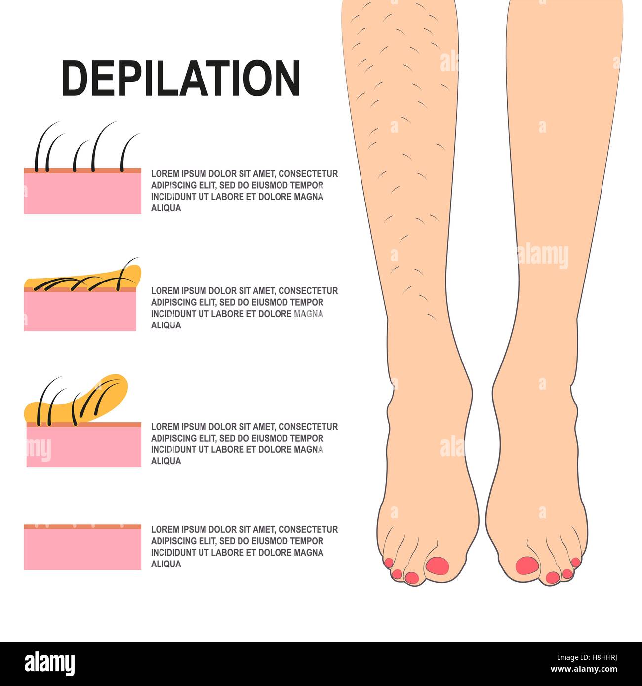 Laser Depilation Stock Photos & Laser Depilation Stock Images - Alamy