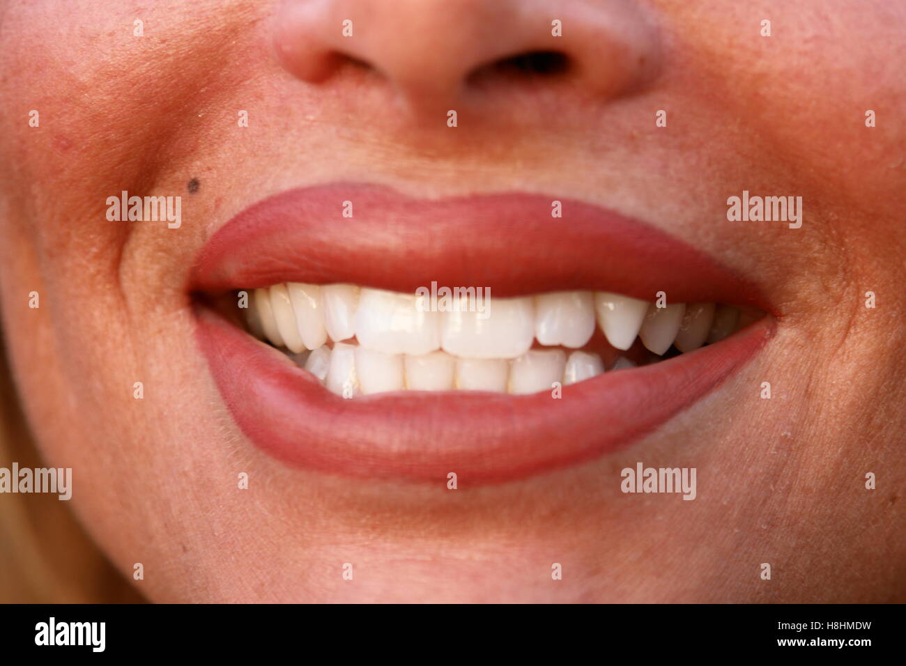 Close up of a woman's smile Stock Photo - Alamy