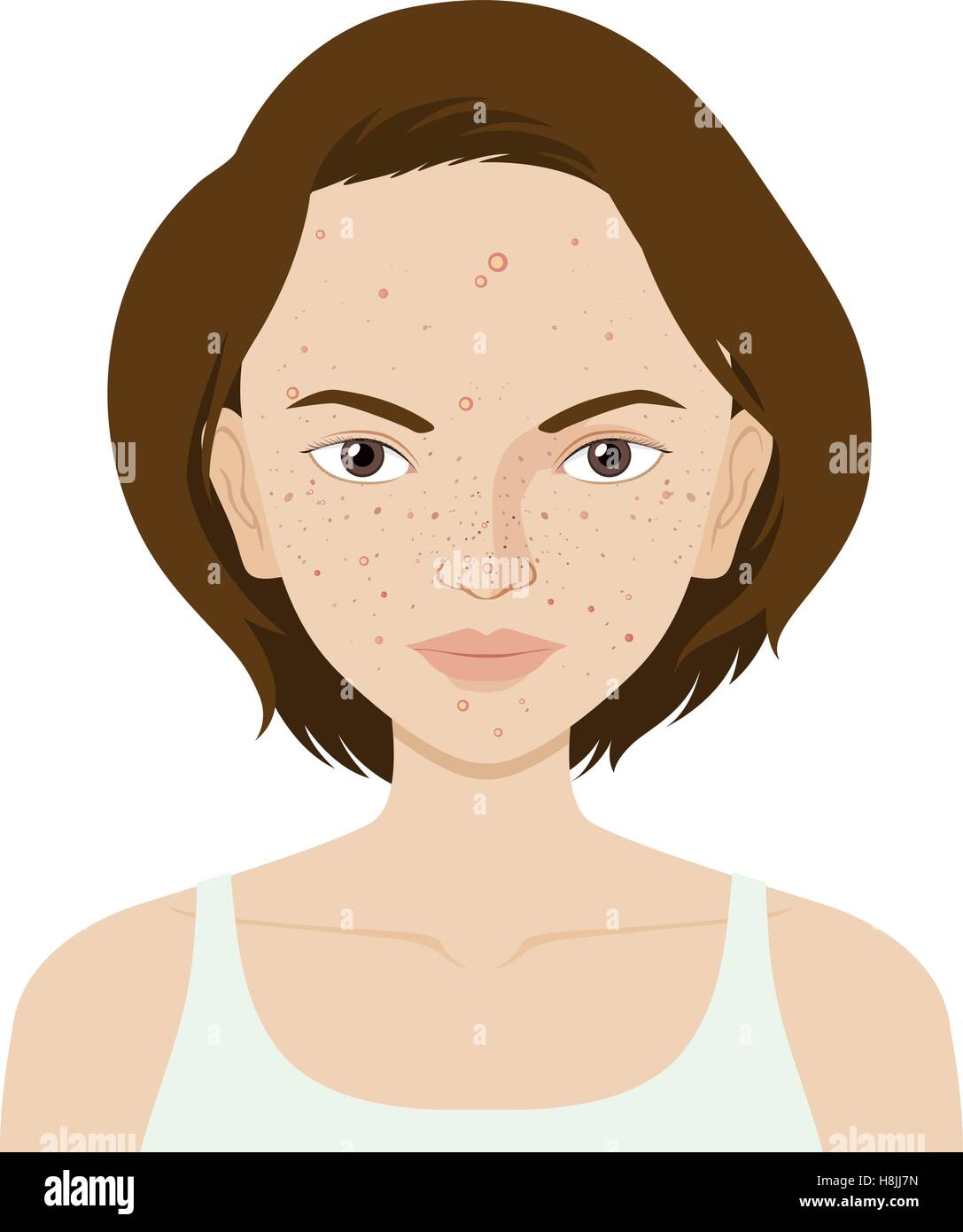 Woman with facial skin problem illustration Stock Vector Image & Art ...