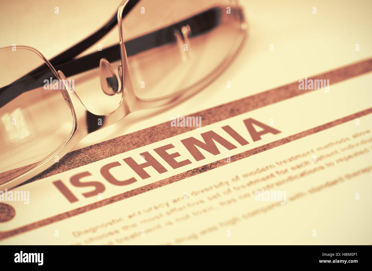 Chronic ischemia hi-res stock photography and images - Alamy