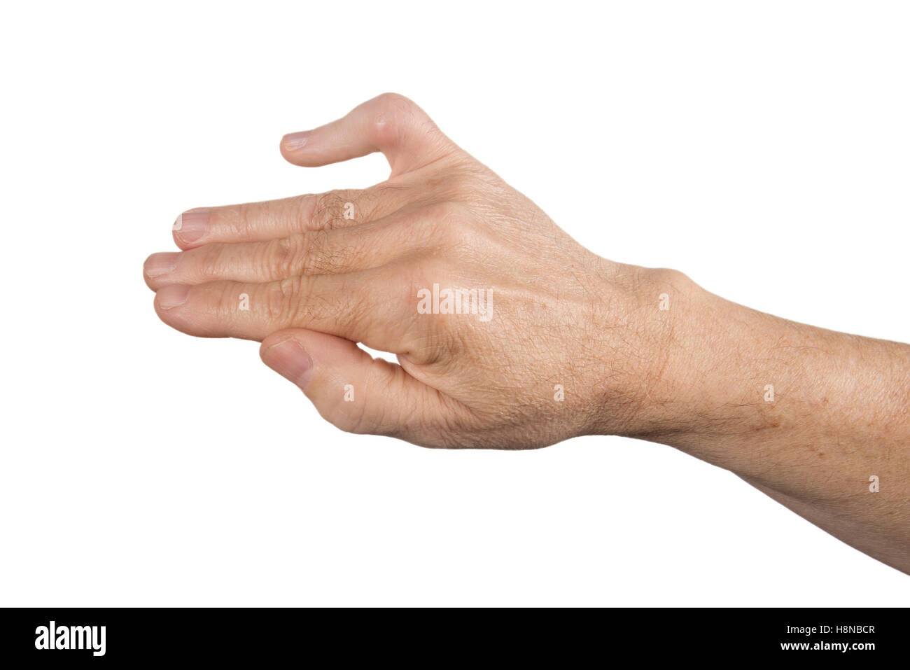 Broken finger hi-res stock photography and images - Alamy