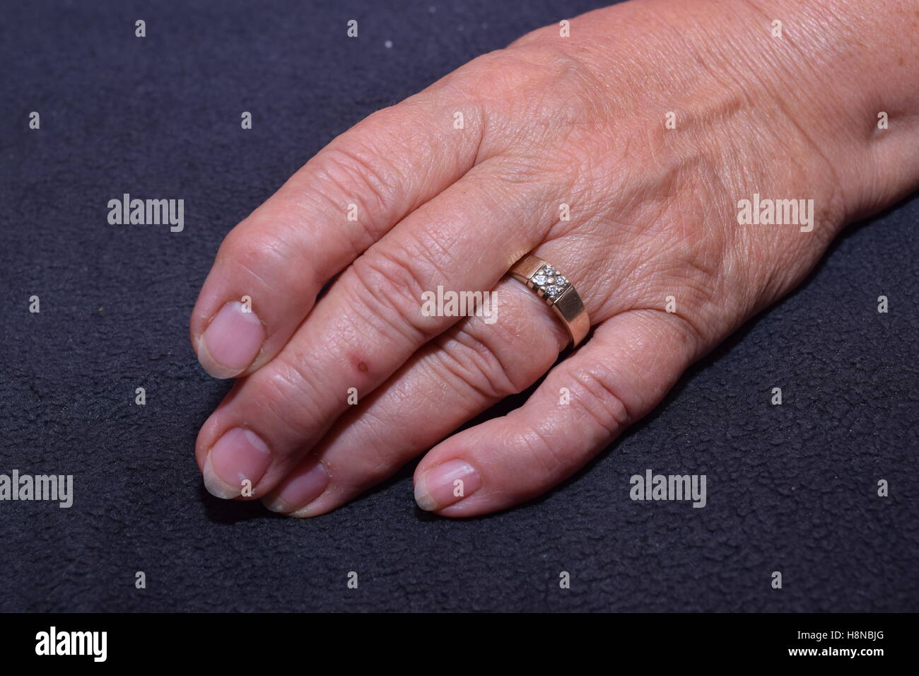 Senior female wearing a wedding ring Stock Photo - Alamy