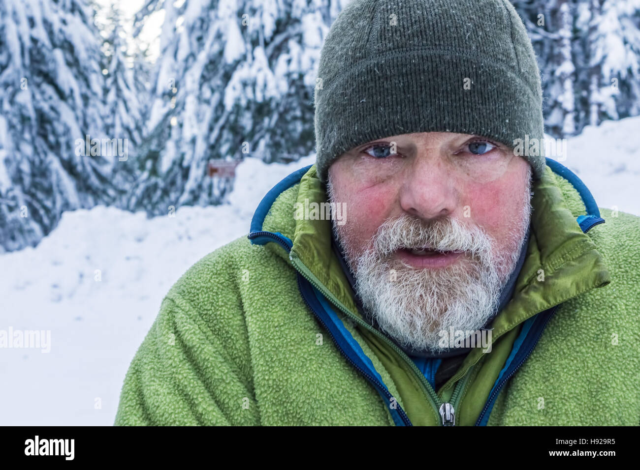 winter cold face Stock Photo - Alamy