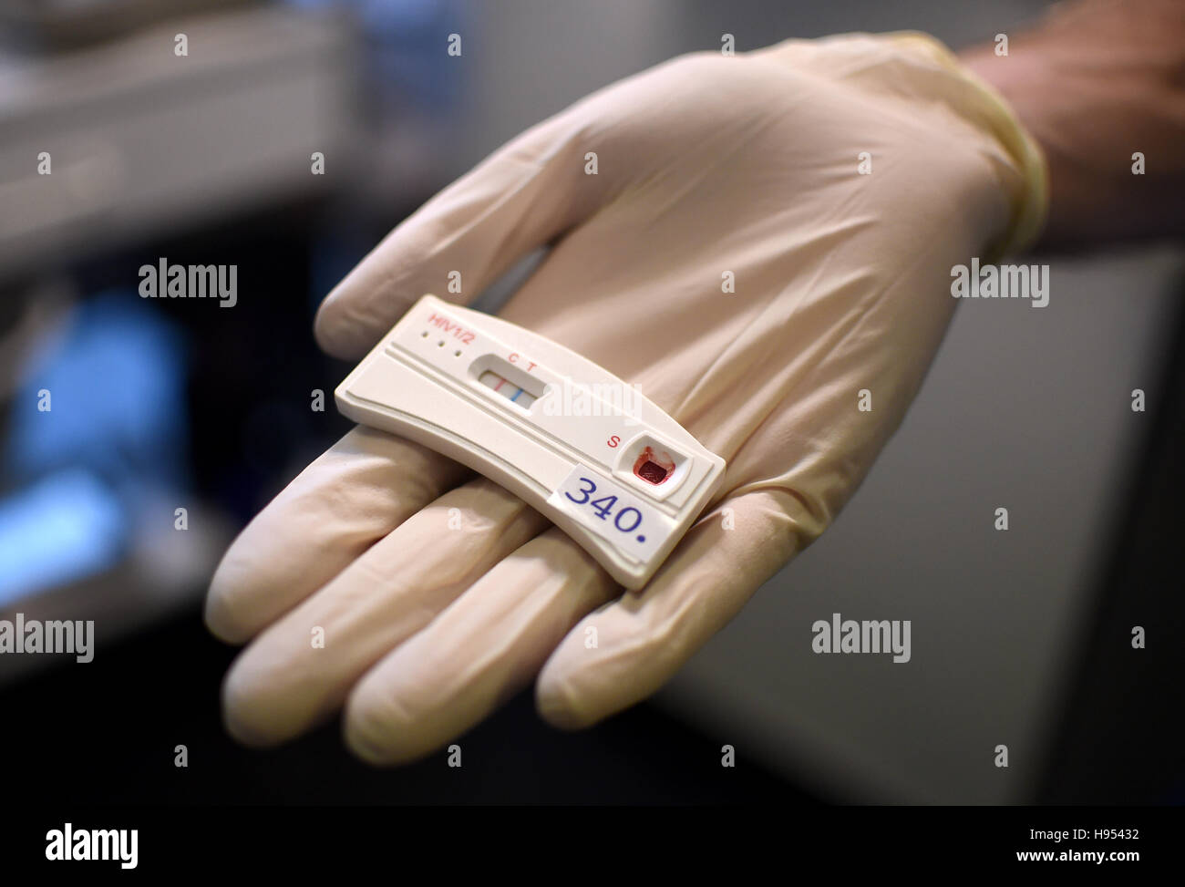 A test strip of an HIV quick tests can be seen coloured after ...