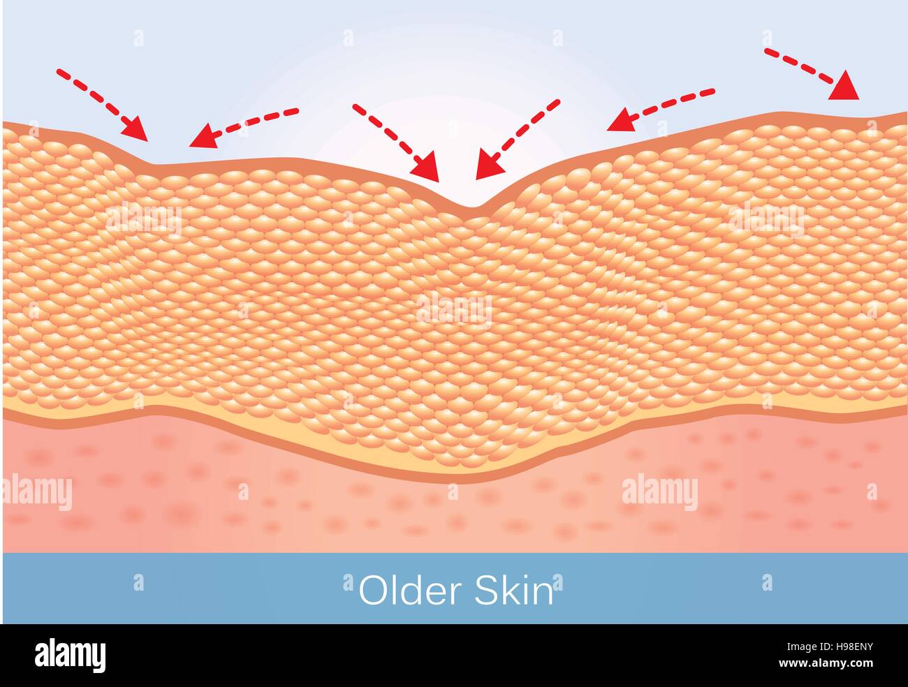 Skin conditions Stock Vector Images - Alamy
