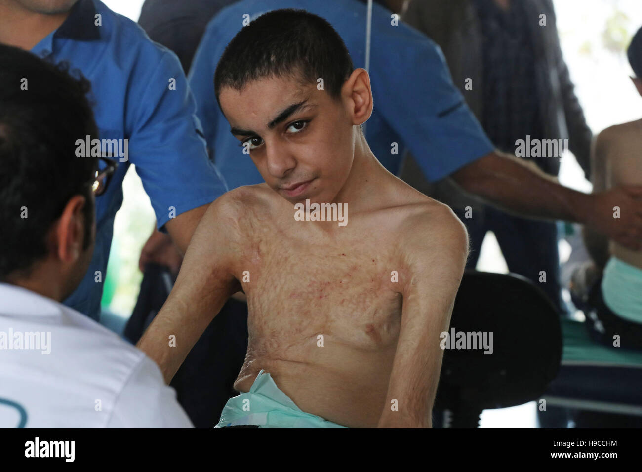 Syrian refugee Ahmad El Alayi, 12, undergoing treatment at a physical ...