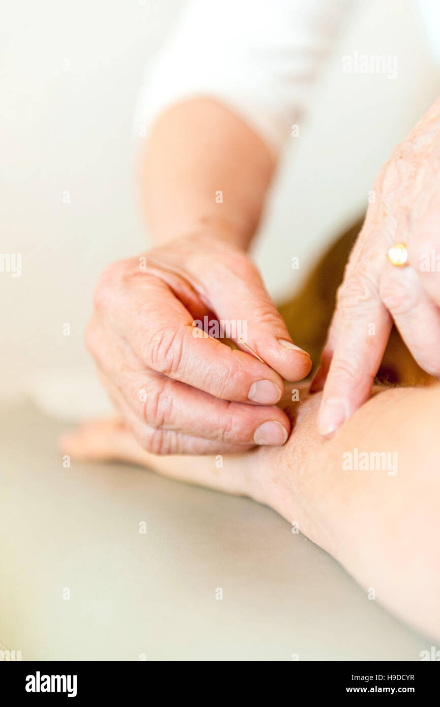 Acupuncture session, treatment Stock Photo - Alamy