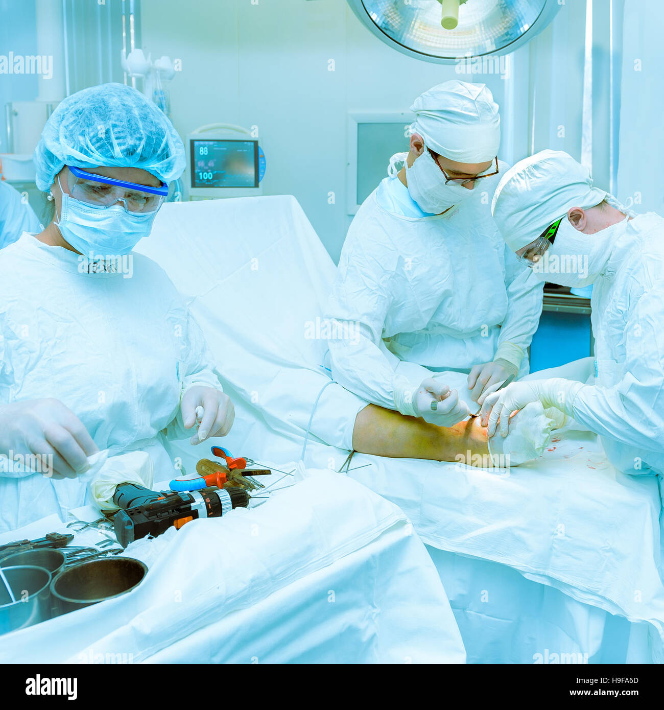 Group of doctors doing the actual operation in the traumatology ...