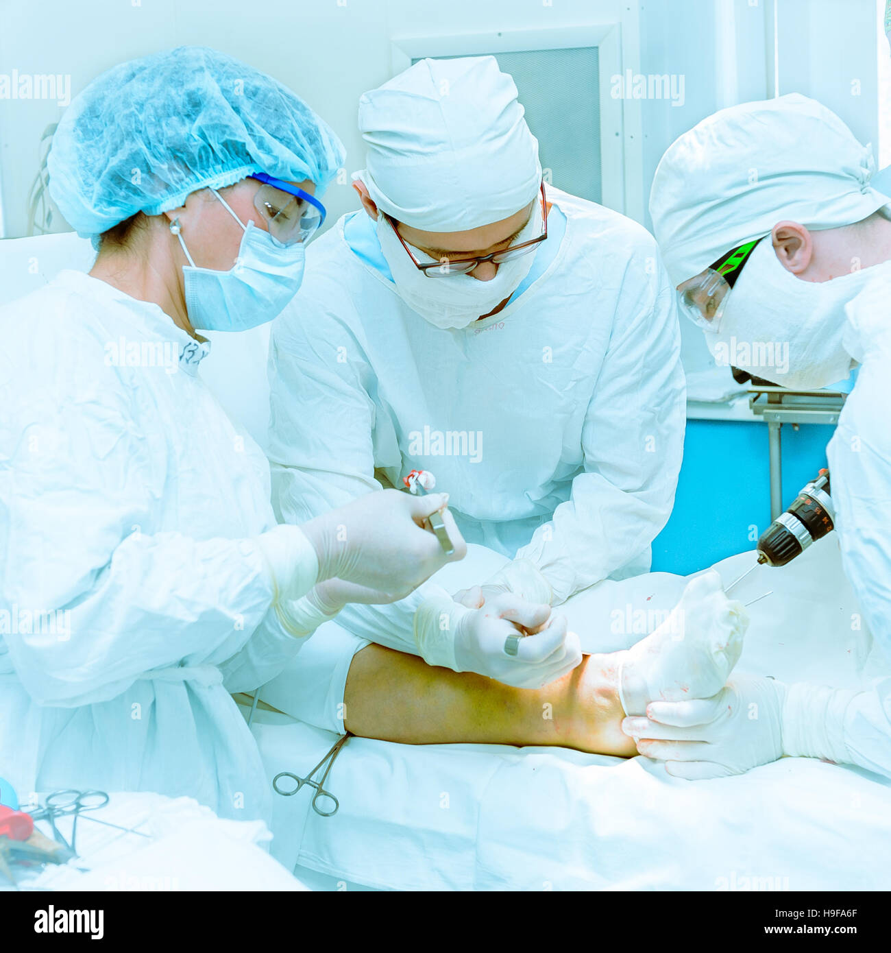 Group of doctors doing the actual operation in the traumatology ...
