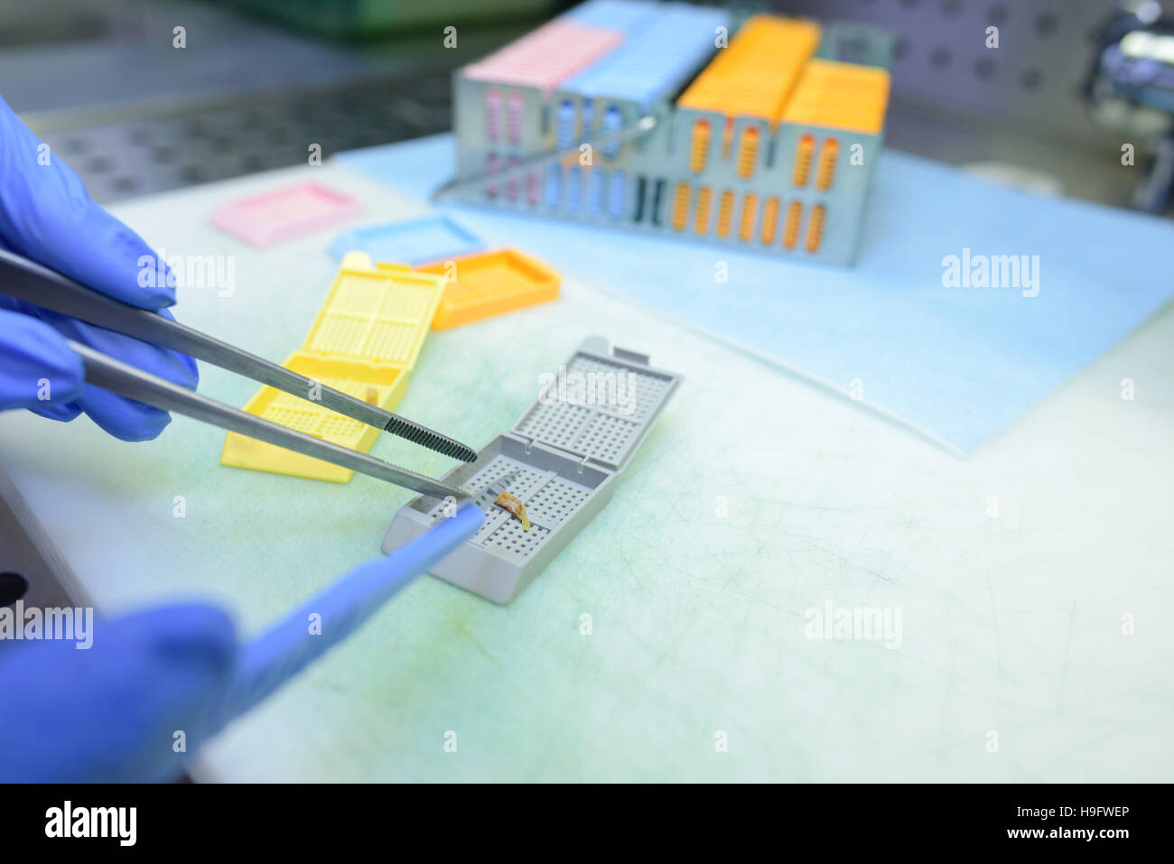 Small object being handled with tweezers Stock Photo - Alamy