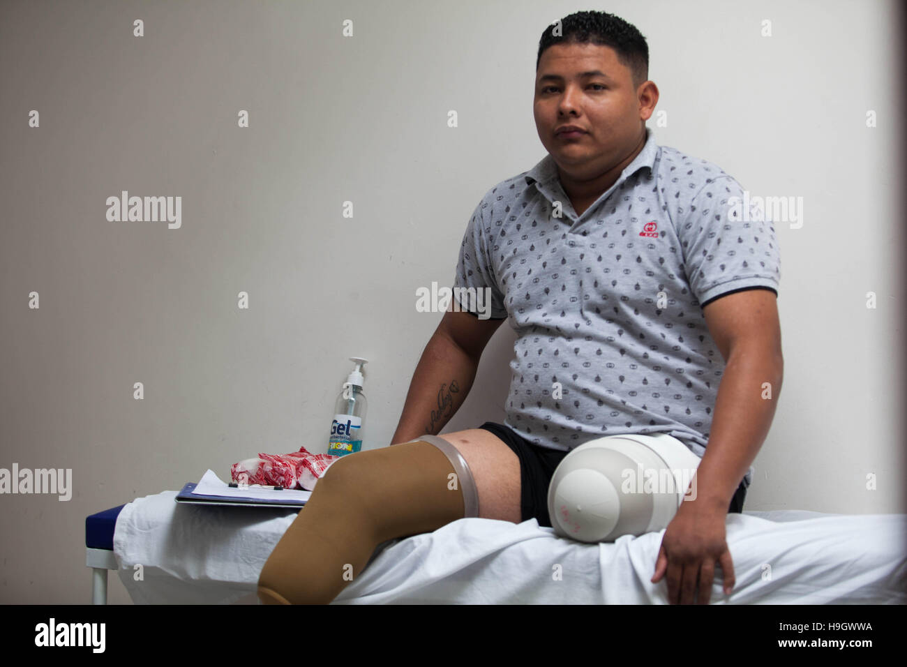 October 10, 2016 - Landmine Victims Receive Donation of 25 Prosthesis ...