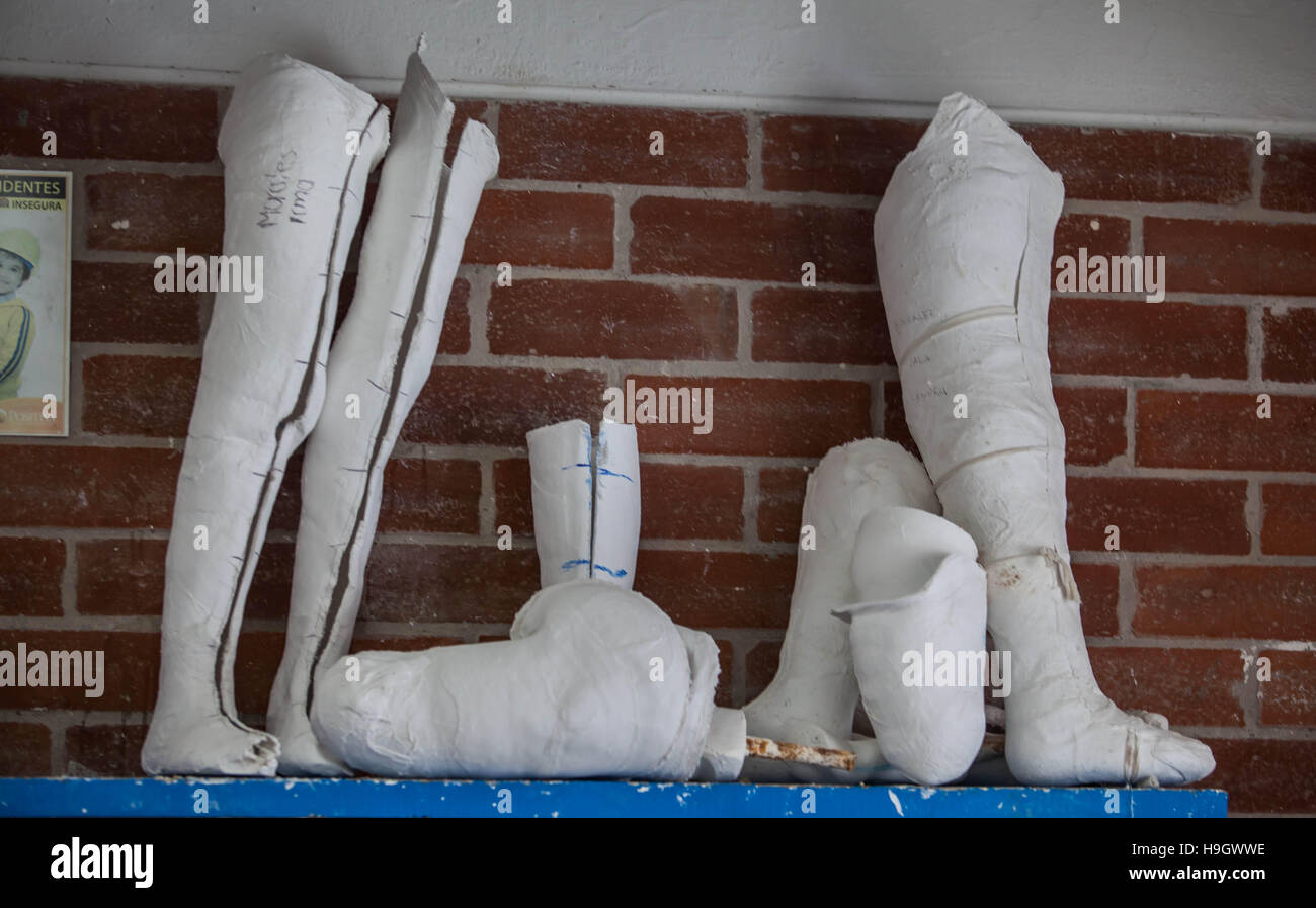 October 10, 2016 - Landmine Victims Receive Donation of 25 Prosthesis ...