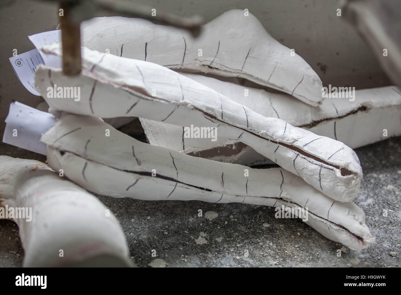 October 10, 2016 - Landmine Victims Receive Donation of 25 Prosthesis ...