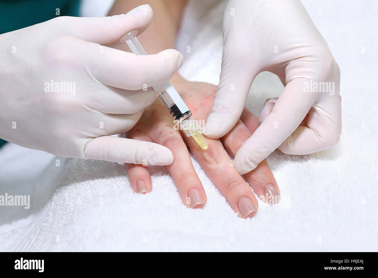 Injection hand hi-res stock photography and images - Alamy