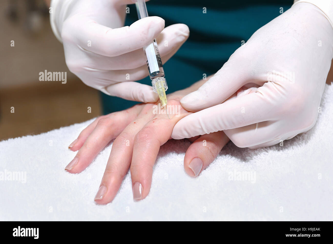 Anti-age injection therapy. Hand rejuvenation Stock Photo - Alamy