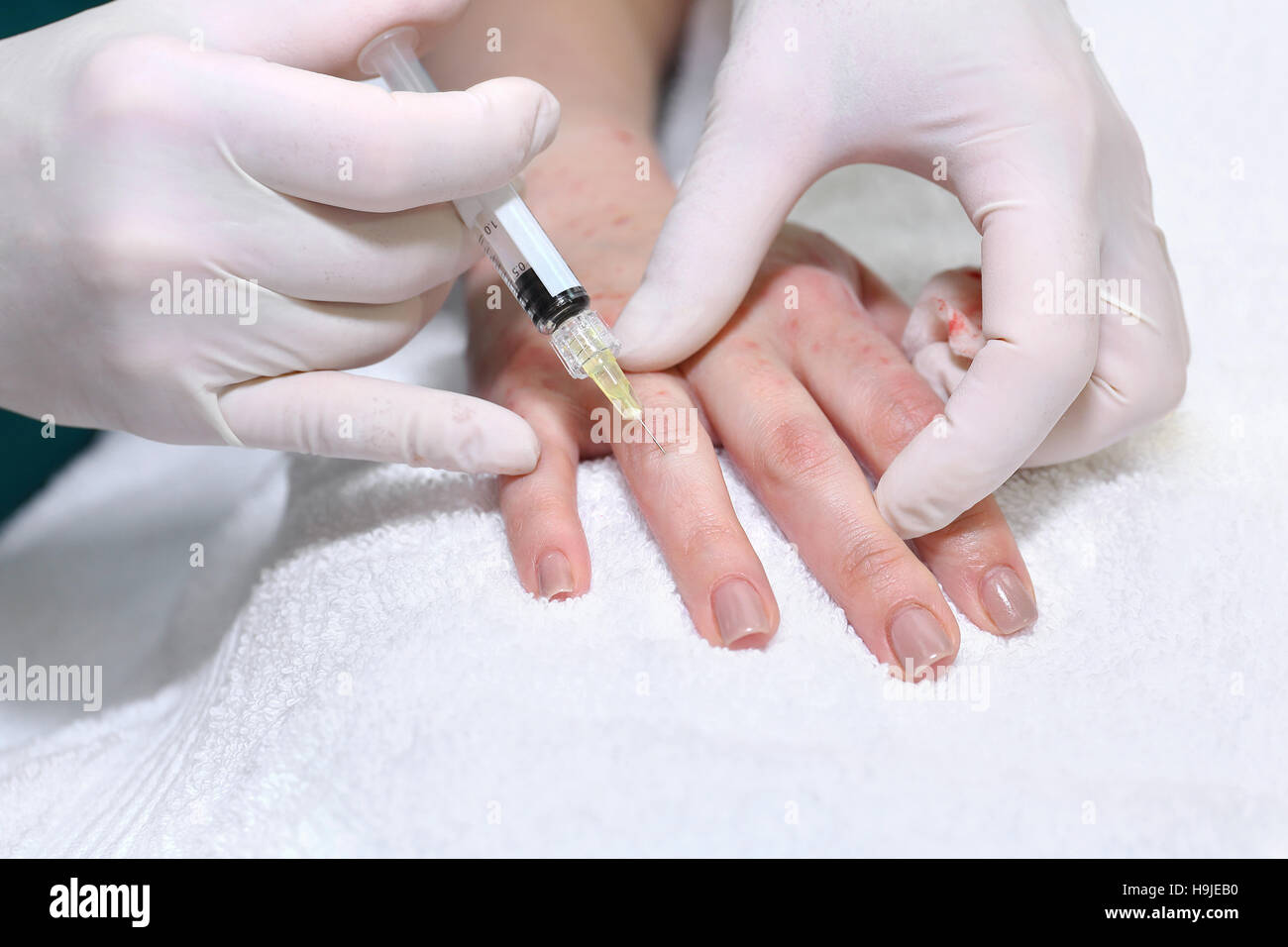 Rejuvenation hi-res stock photography and images - Alamy