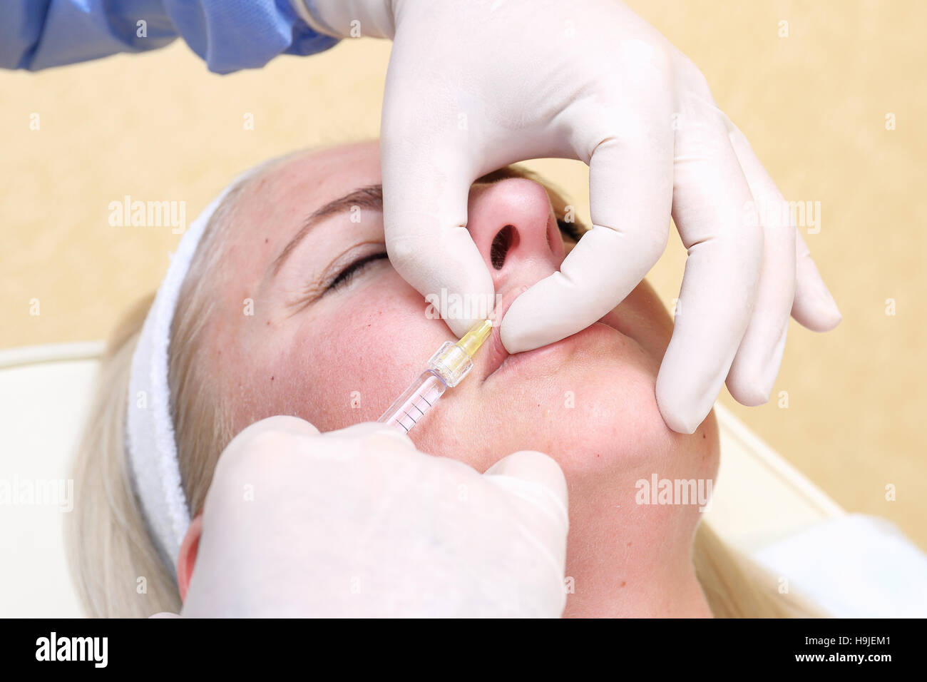 Procedure of lip injection with filler Stock Photo - Alamy