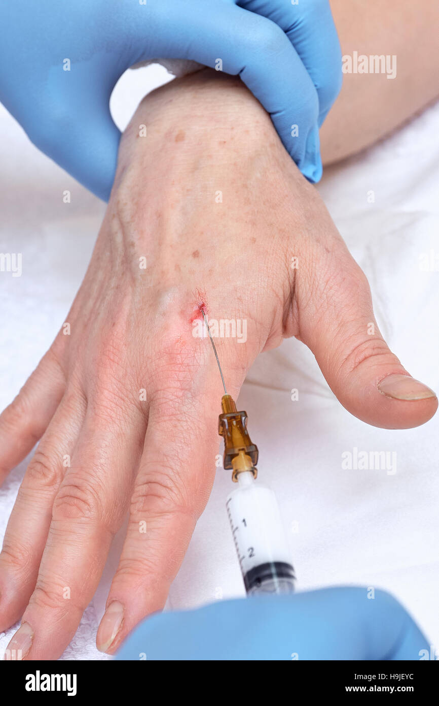 Injection needle hand hi-res stock photography and images - Alamy