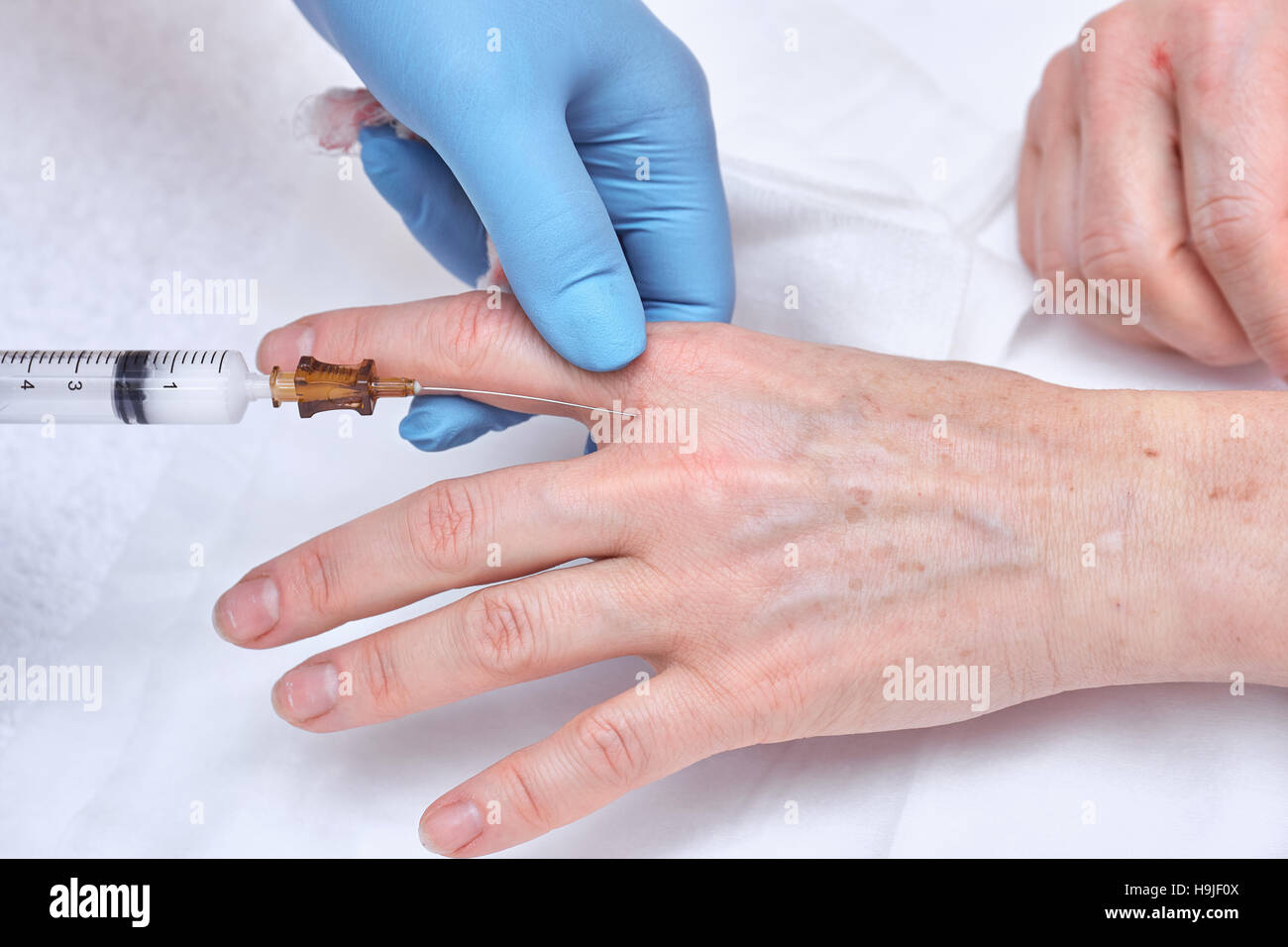 Anti-age injection therapy. Hand rejuvenation Stock Photo - Alamy