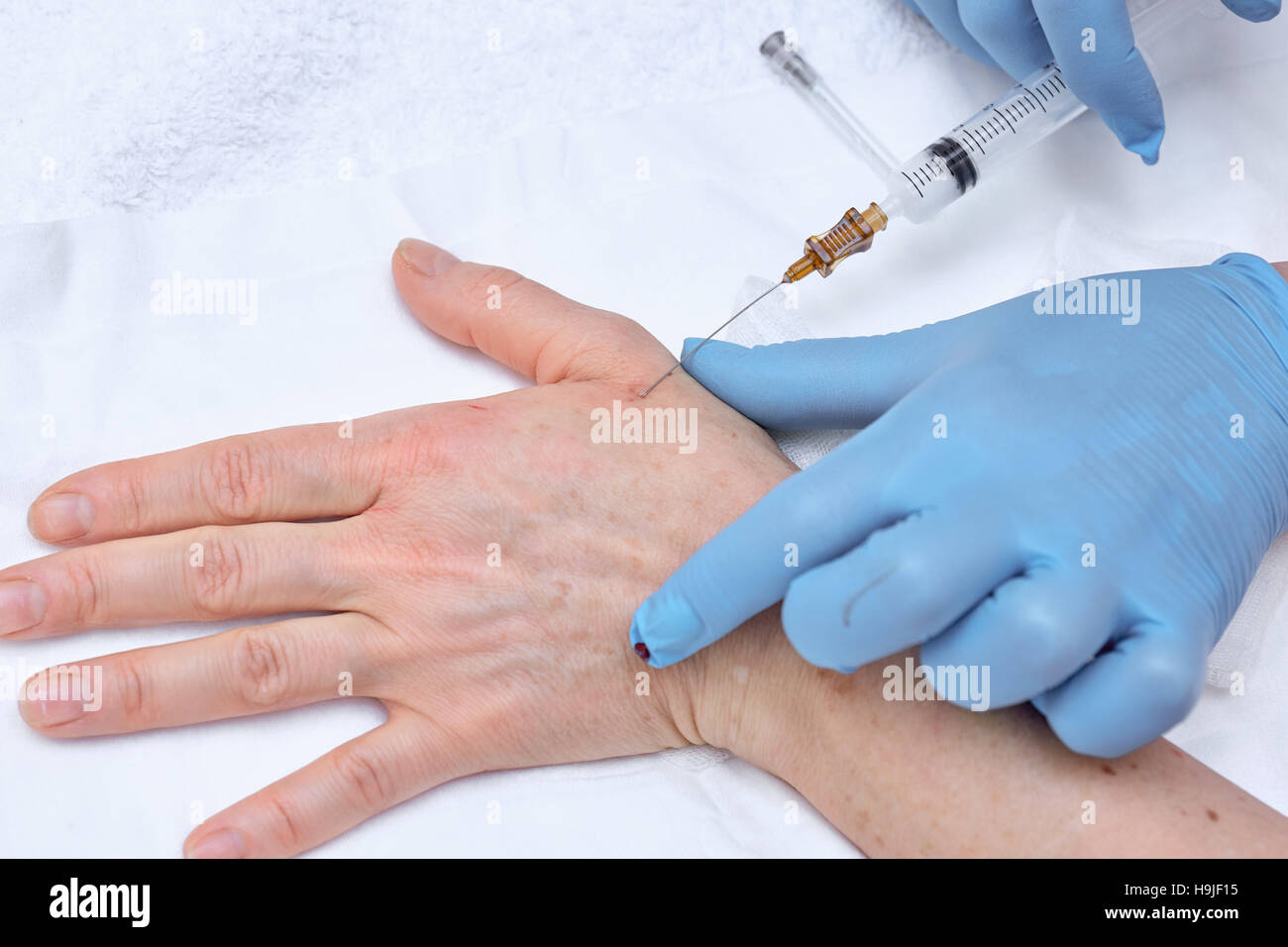 Anti-age injection therapy. Hand rejuvenation Stock Photo - Alamy
