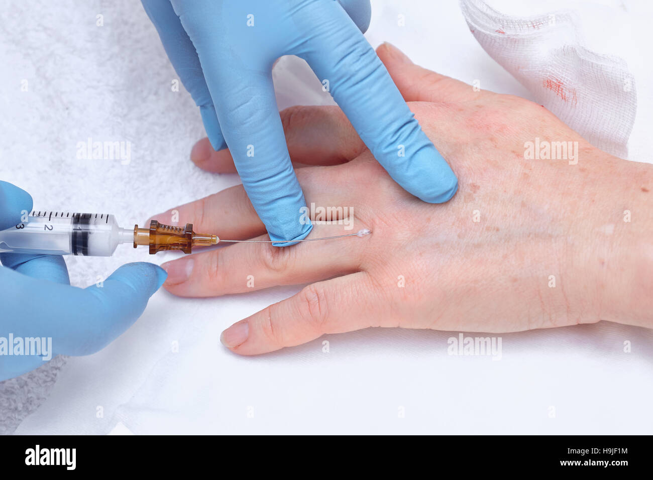 Anti-age injection therapy. Hand rejuvenation Stock Photo - Alamy