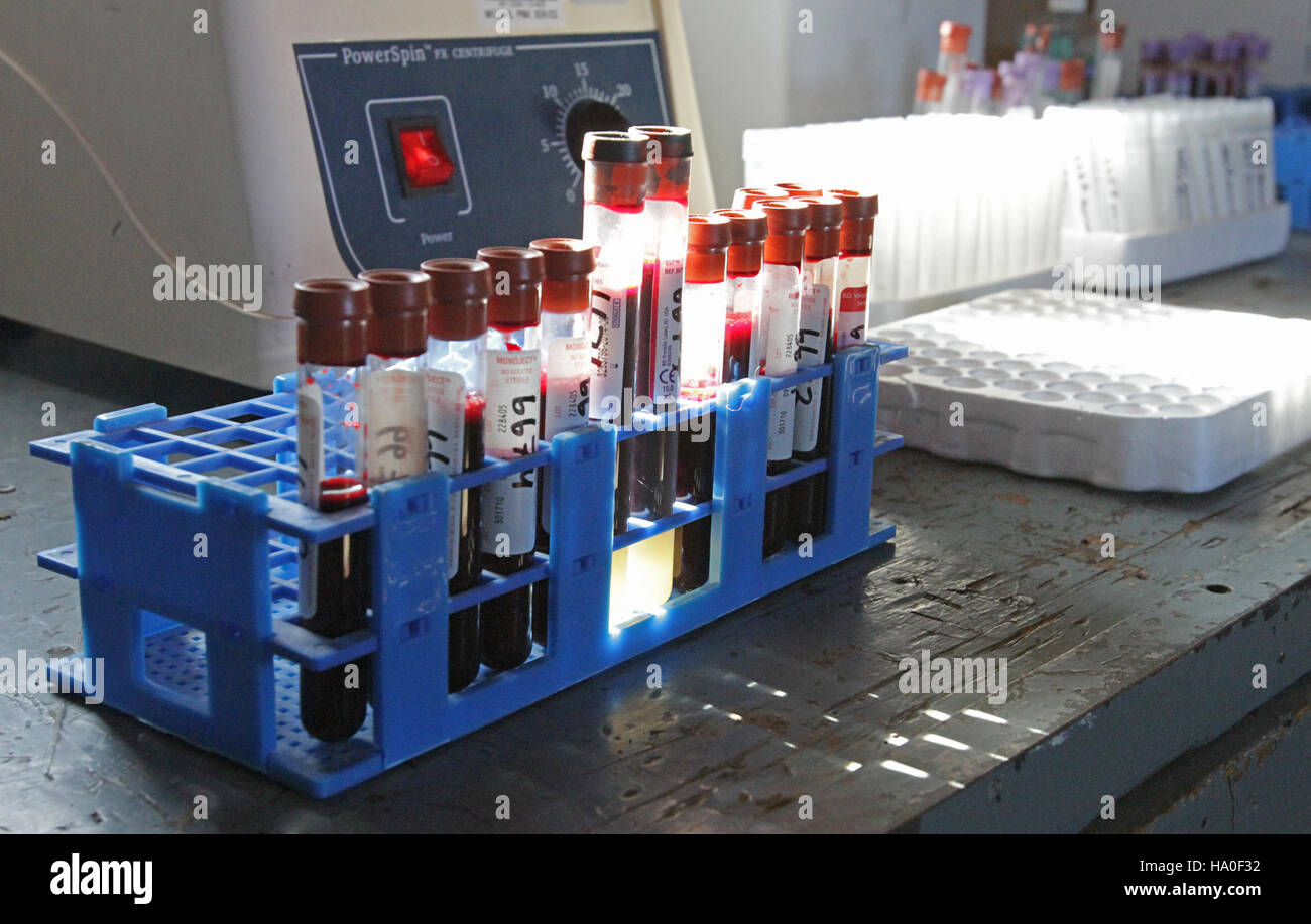 Blood vials from bison at the Stephens Creek bison pens in Yellowstone ...