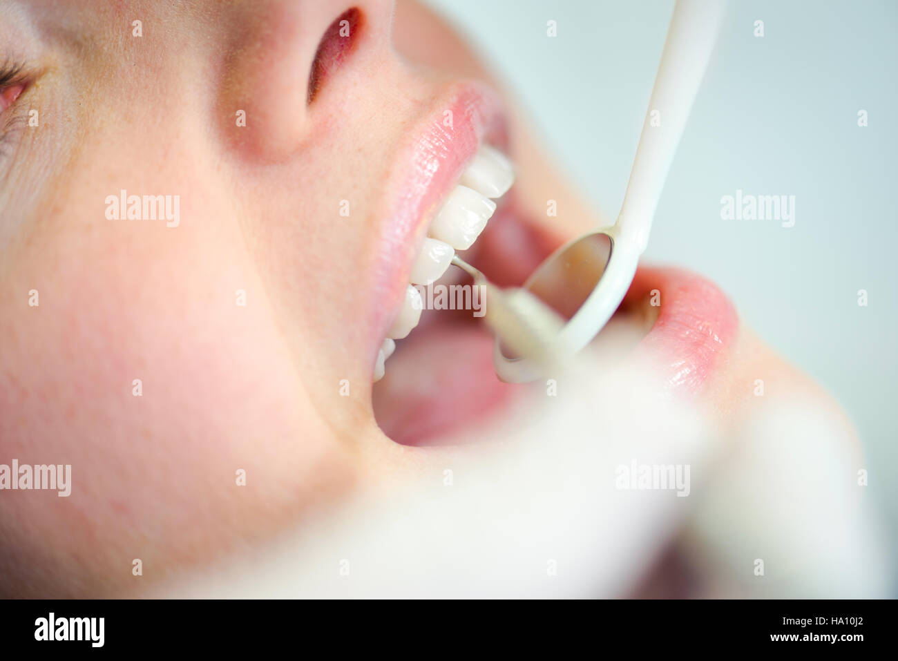 Dentist woman extraction hi-res stock photography and images - Alamy