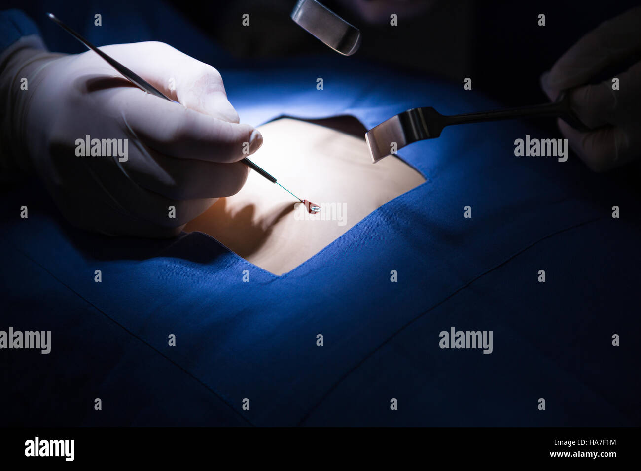 Sensitive operation hi-res stock photography and images - Alamy