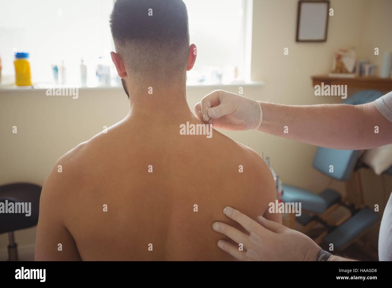 Physiotherapist performing dry needling on patient Stock Photo - Alamy