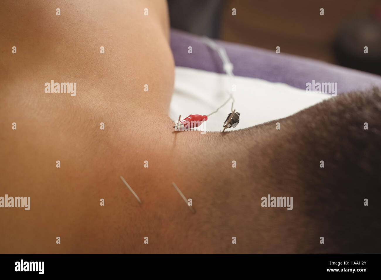 Back and neck hi-res stock photography and images - Alamy