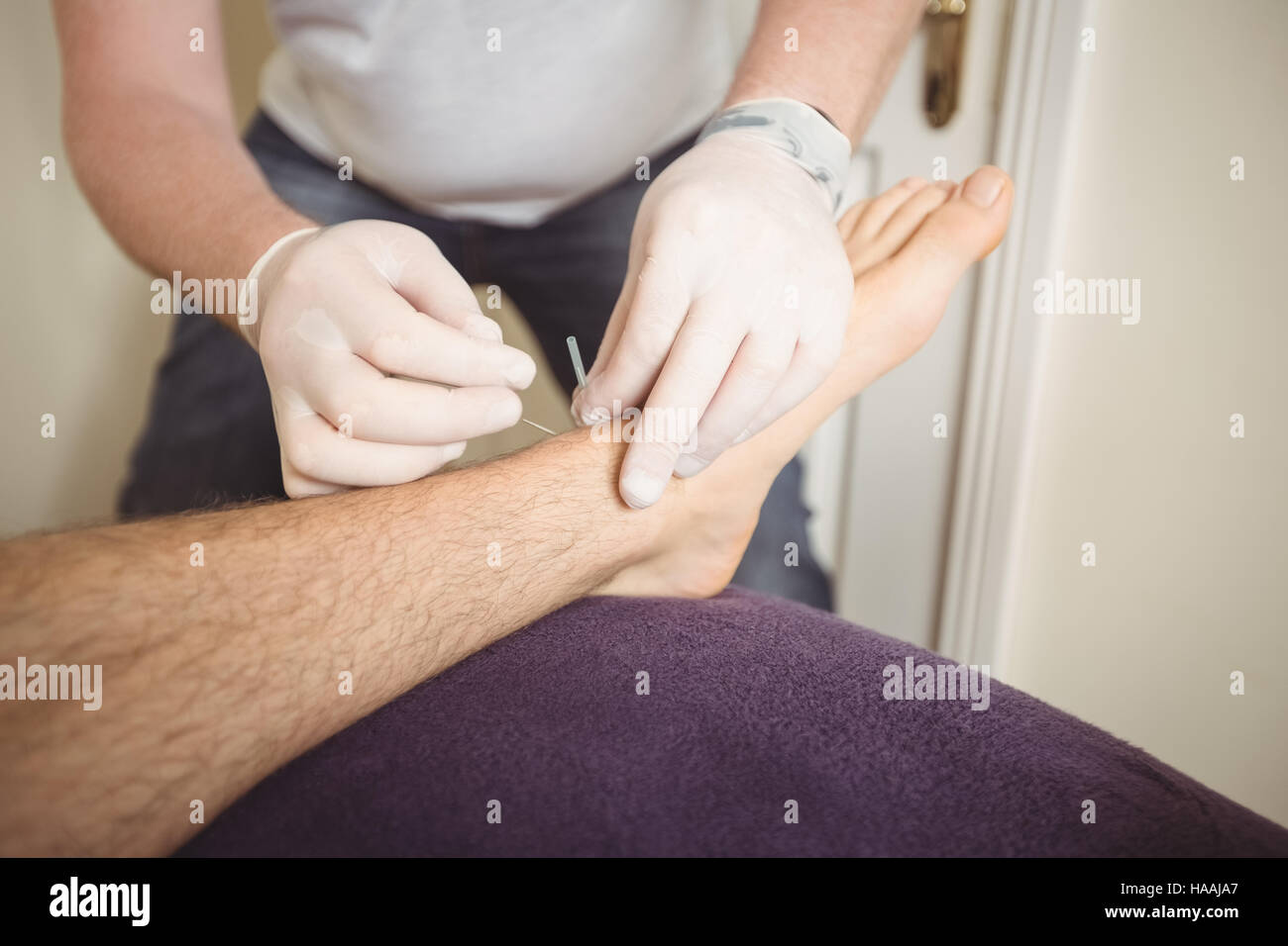 Physiotherapist performing dry needling on the leg of a patient Stock ...