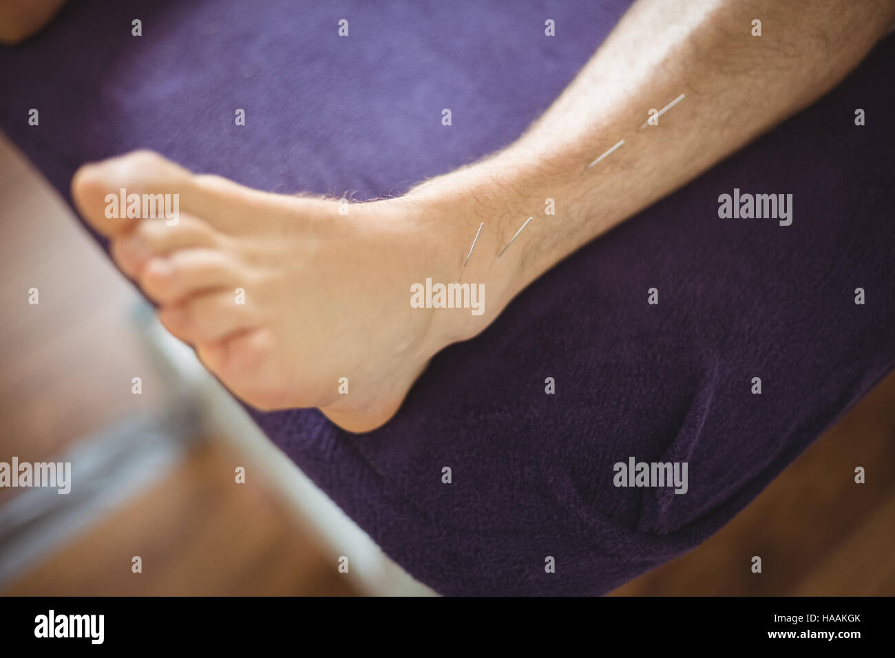 Patient foot leg ankle hi-res stock photography and images - Alamy