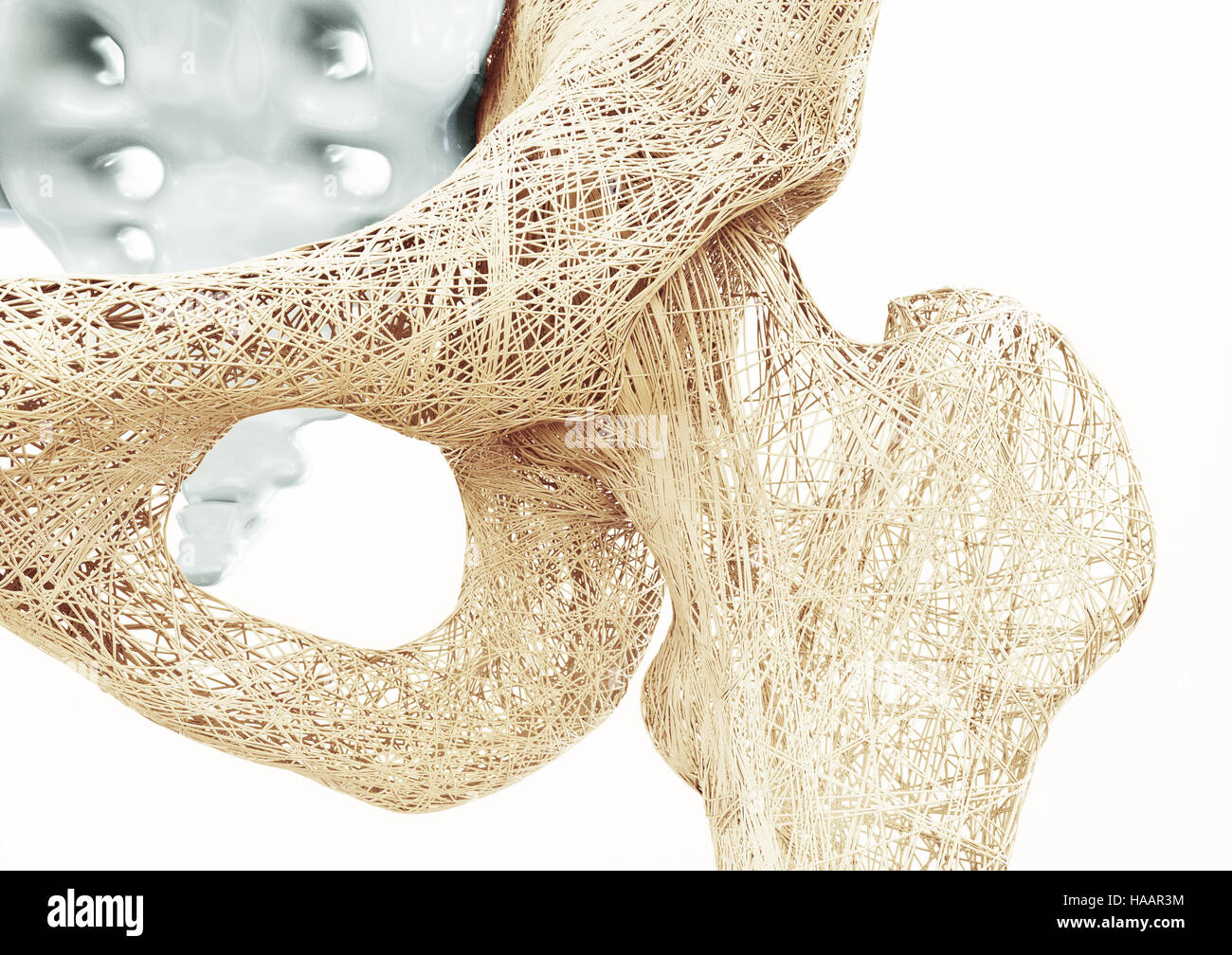 Osteoporosis hi-res stock photography and images - Alamy