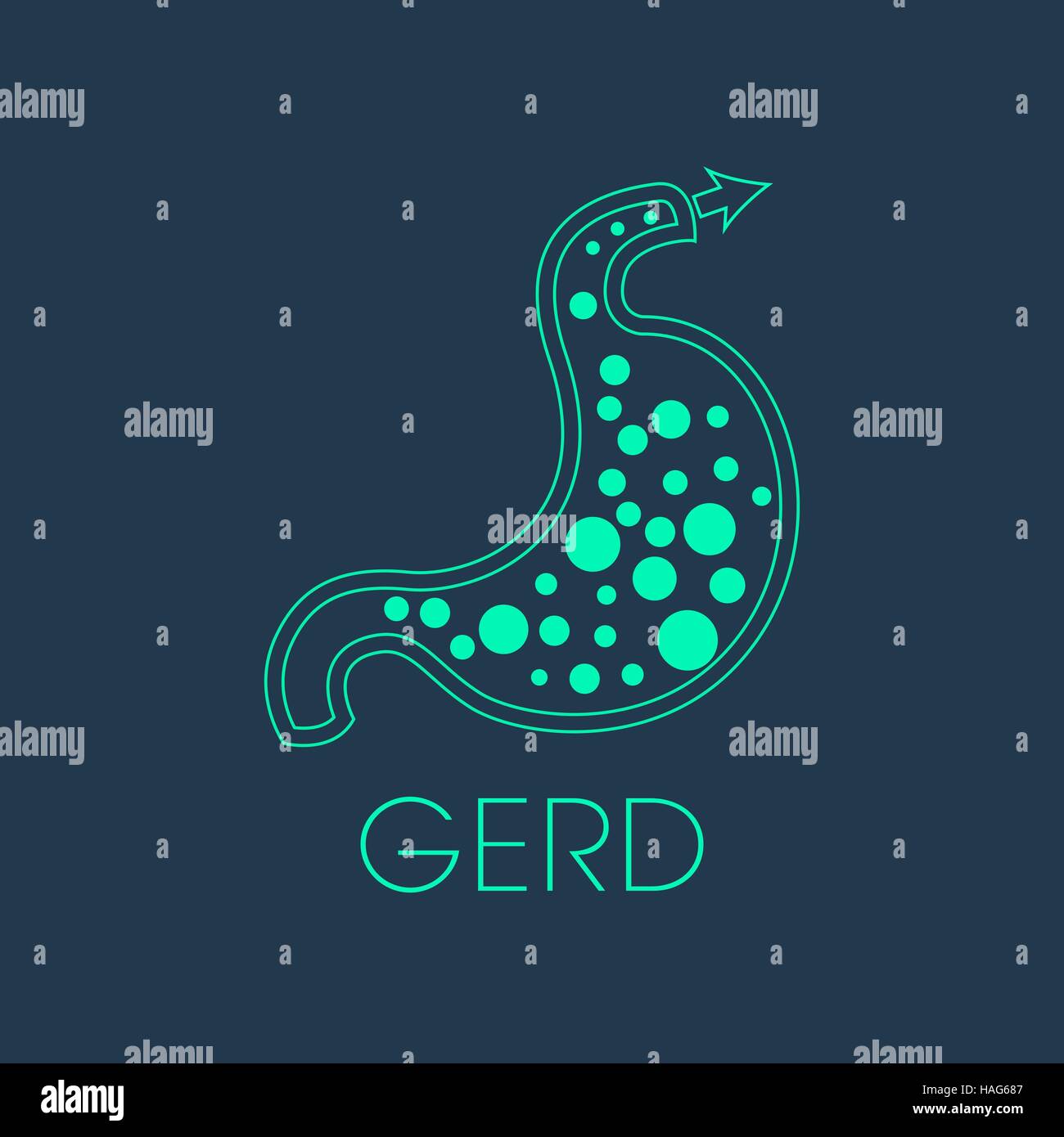 Gerd science hi-res stock photography and images - Alamy