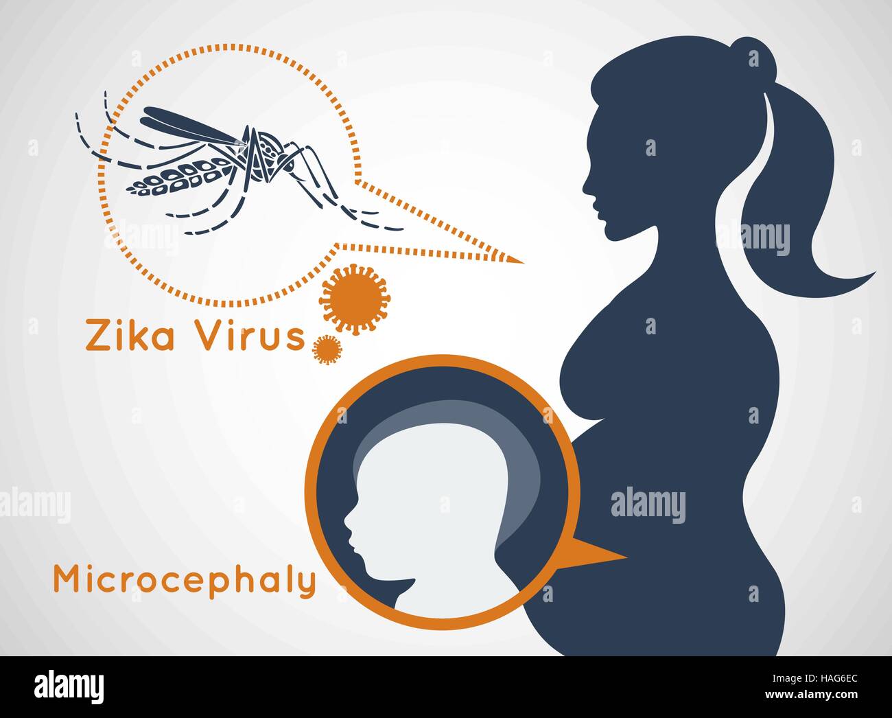 Microcephaly or Abnormal Smallness of the Head Concept. The Zika Fever ...