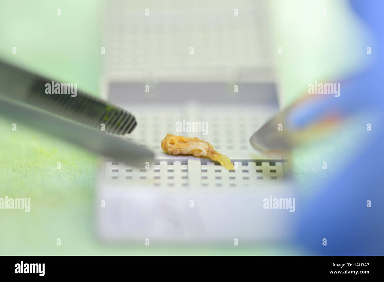 Medical sample hi-res stock photography and images - Alamy