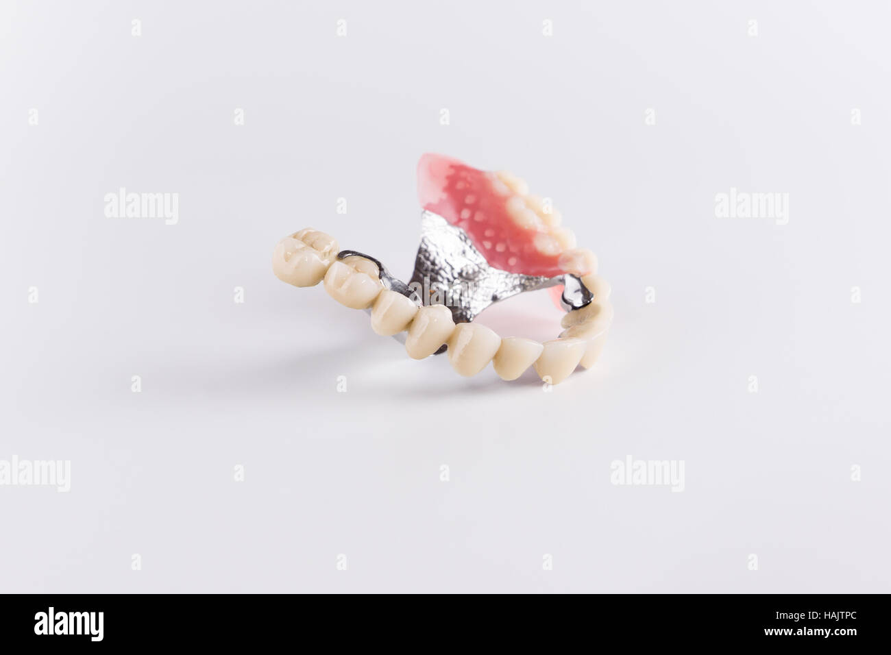 Clasp prosthesis with and attachments fixing ceramic crowns Stock Photo ...