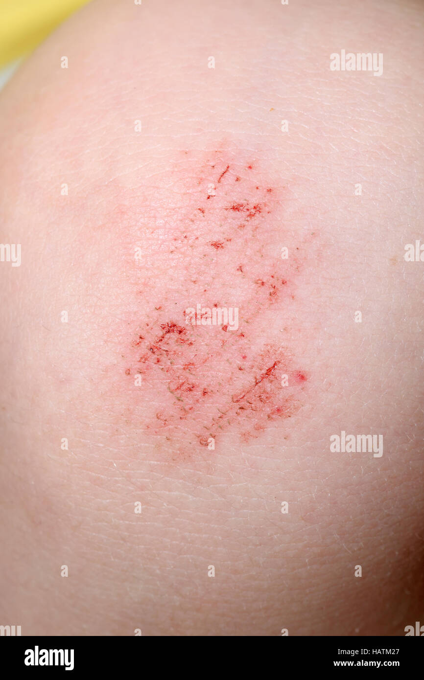Abschurfung hi-res stock photography and images - Alamy