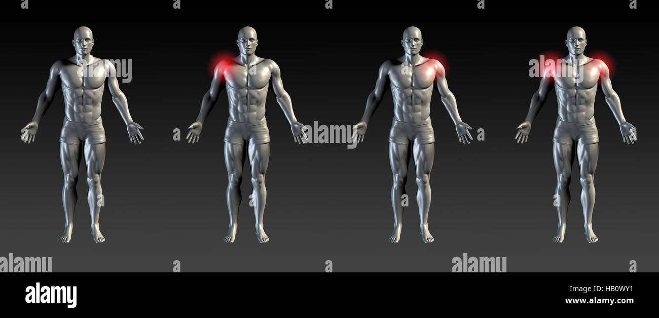 Shoulder pain xray hi-res stock photography and images - Alamy