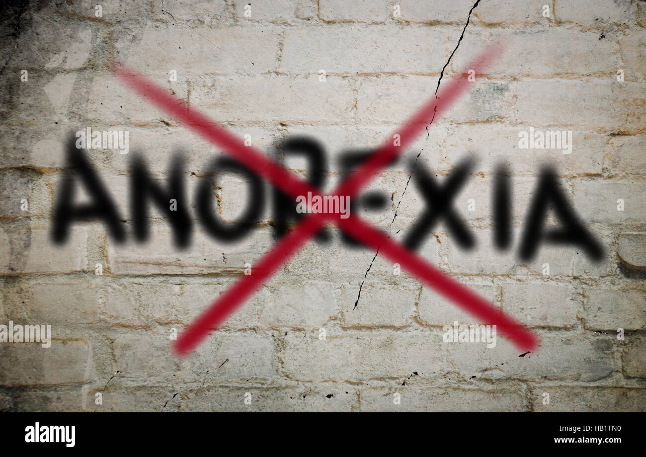 Anorexia nervosa girl hi-res stock photography and images - Alamy