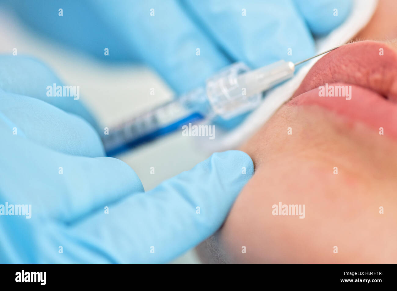 woman gets injection in her lips Stock Photo - Alamy