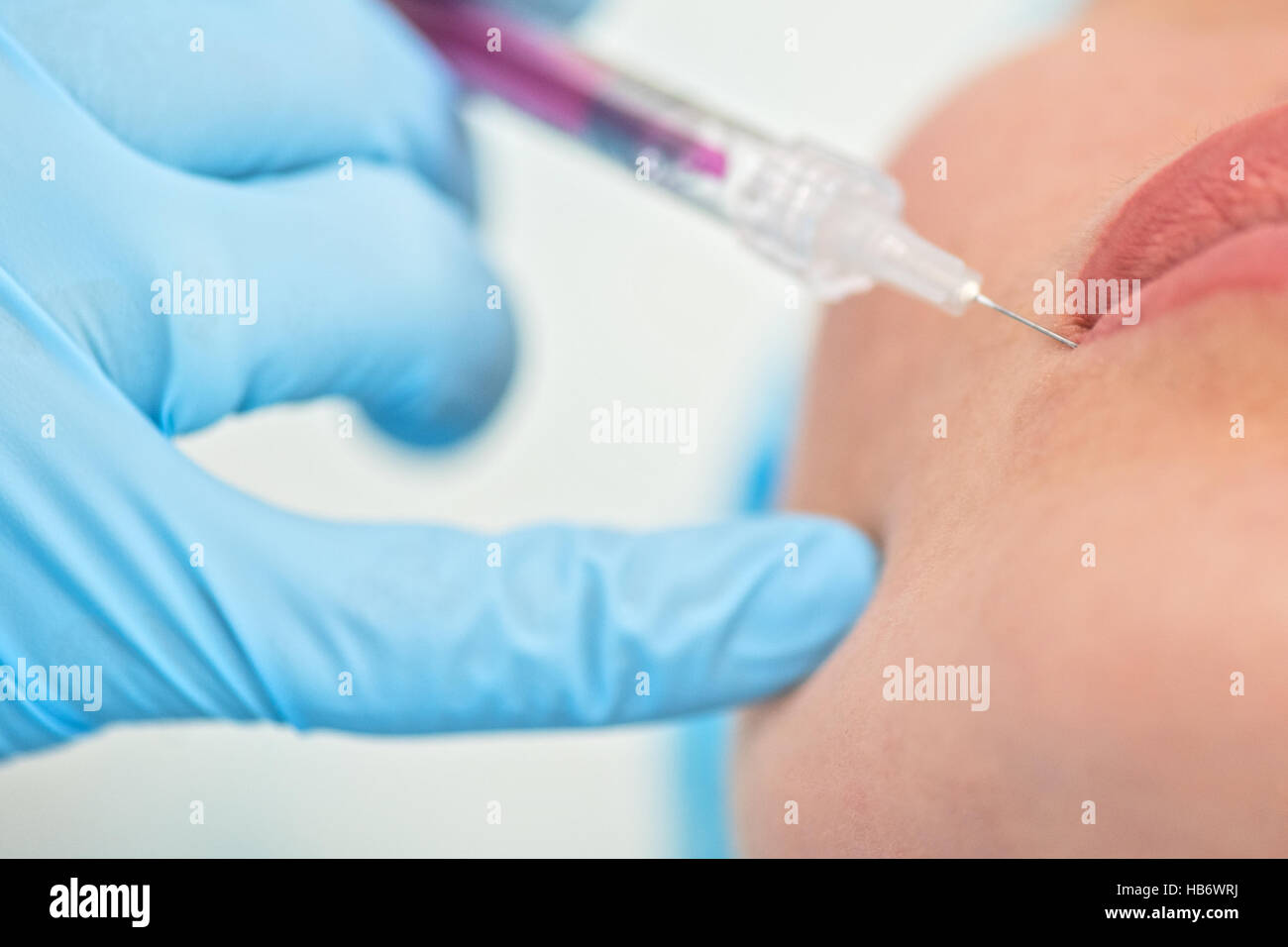 woman gets injection in her lips Stock Photo - Alamy