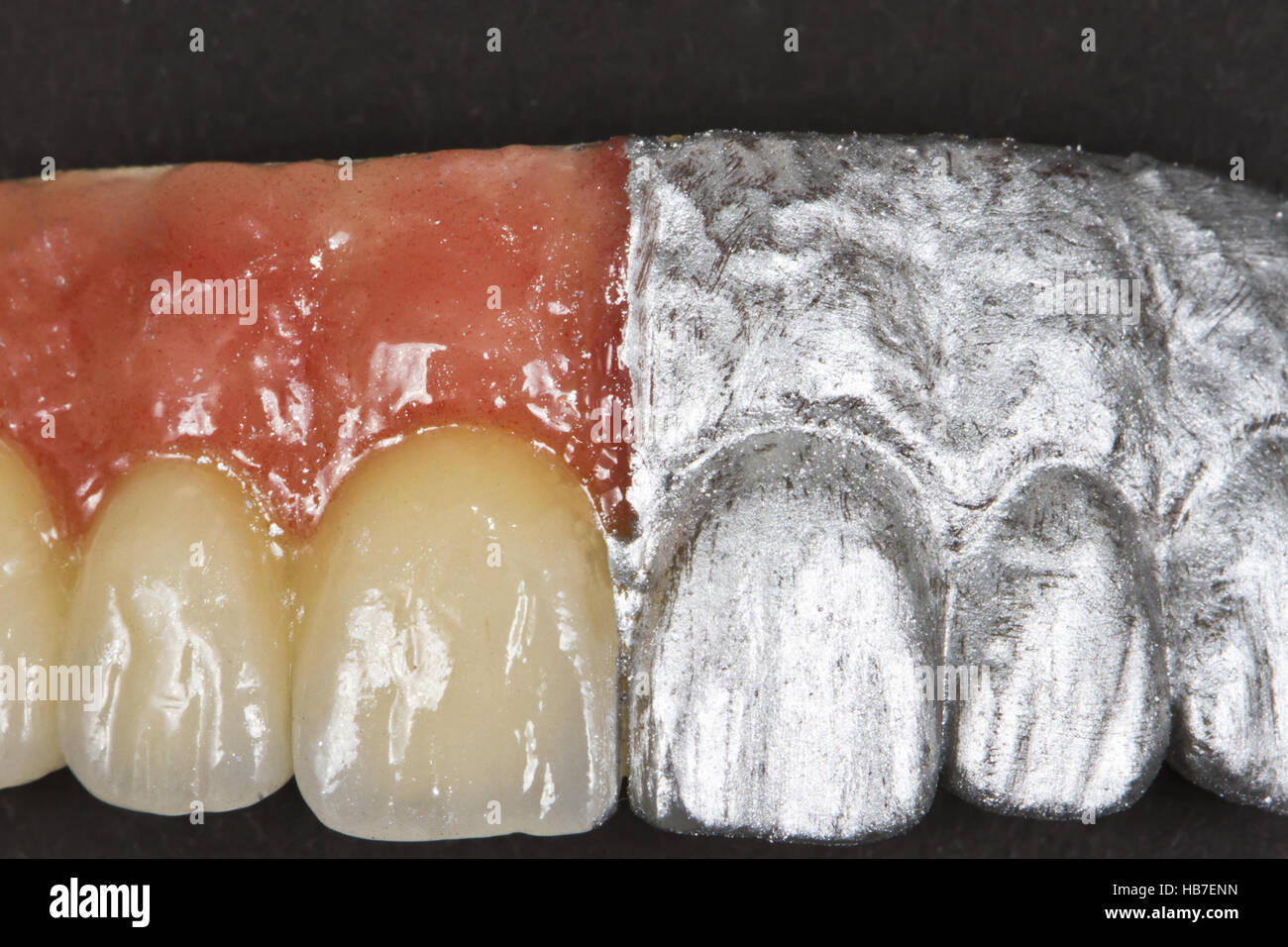 artificail ceramic front teeth and gums Stock Photo - Alamy