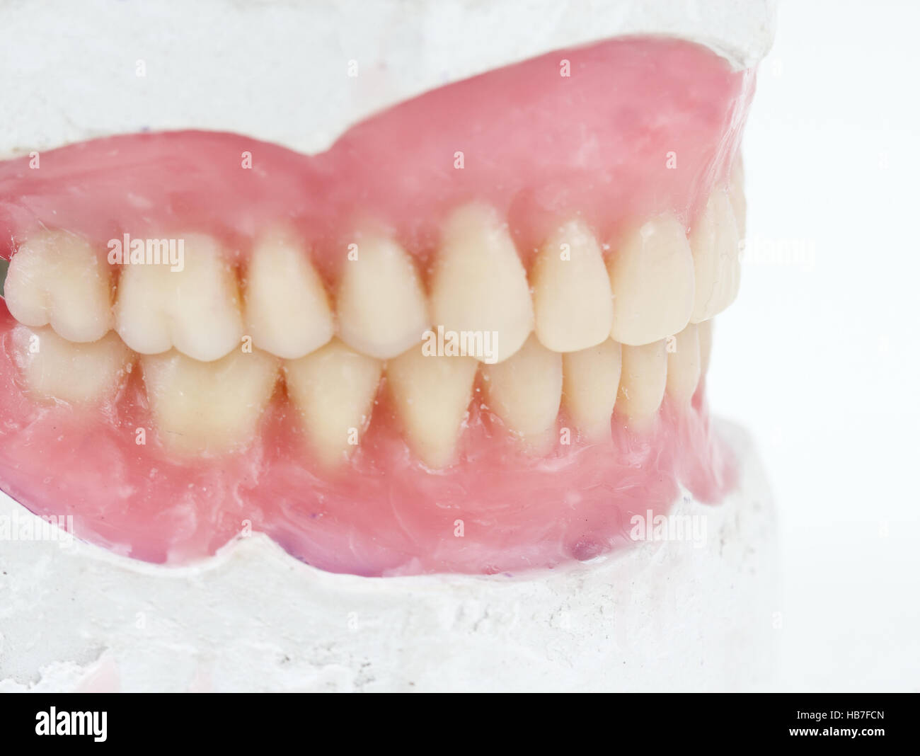 mock- up, for, denta,l total, prosthesis Stock Photo - Alamy