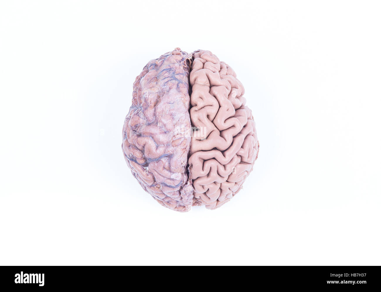 Real brain hi-res stock photography and images - Alamy